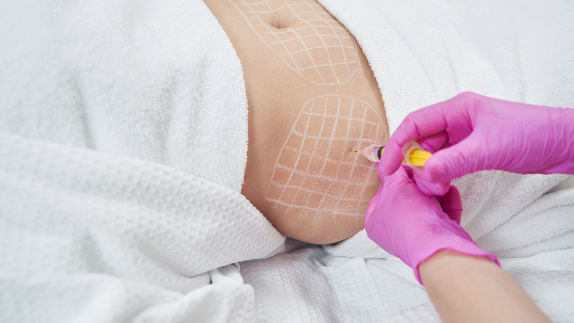 Fat Melting Treatment - DermaCare Wellness & Aesthetics